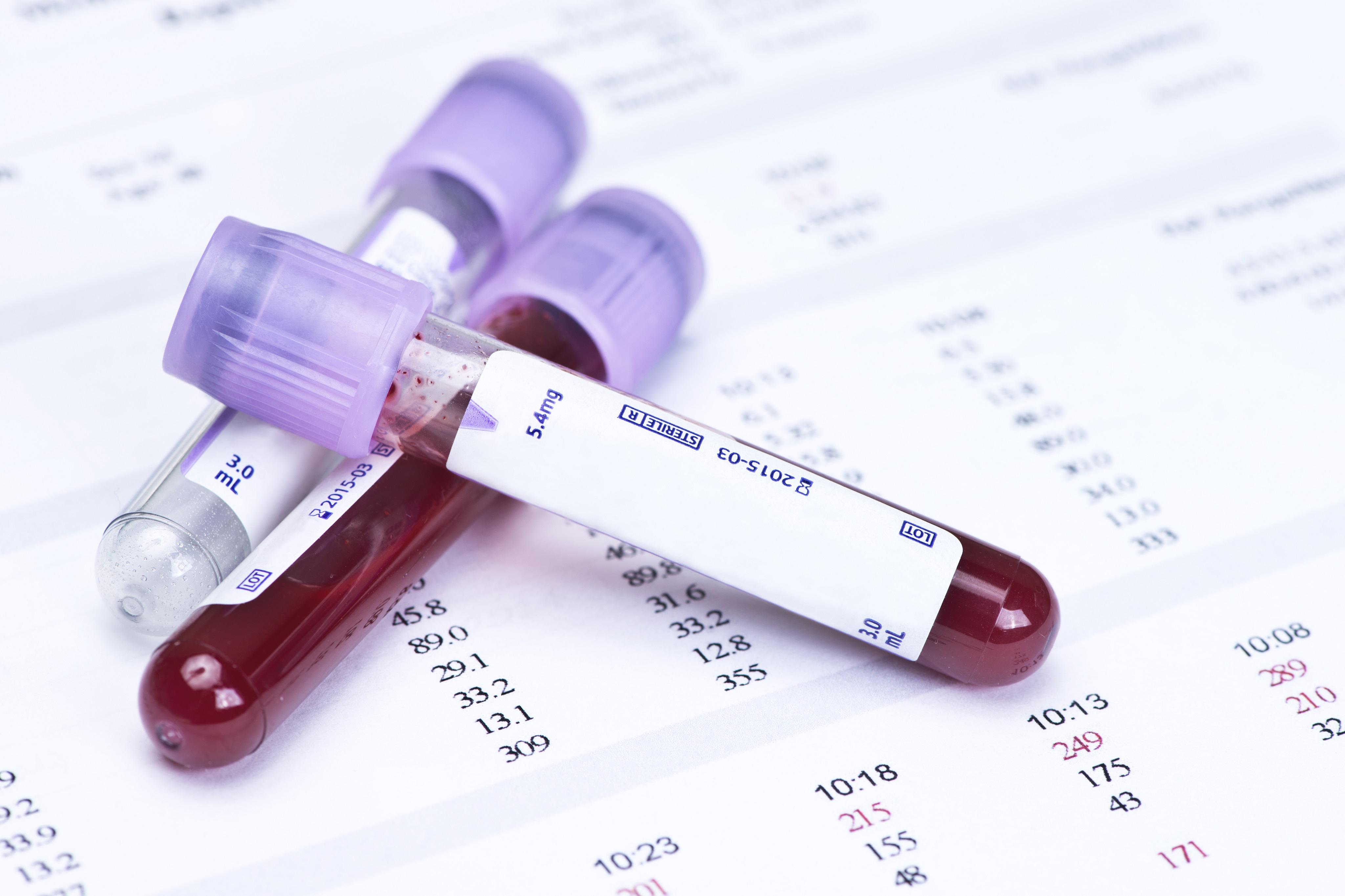 Blood Count Tests MedlinePlus Blood Count Tests MedlinePlus