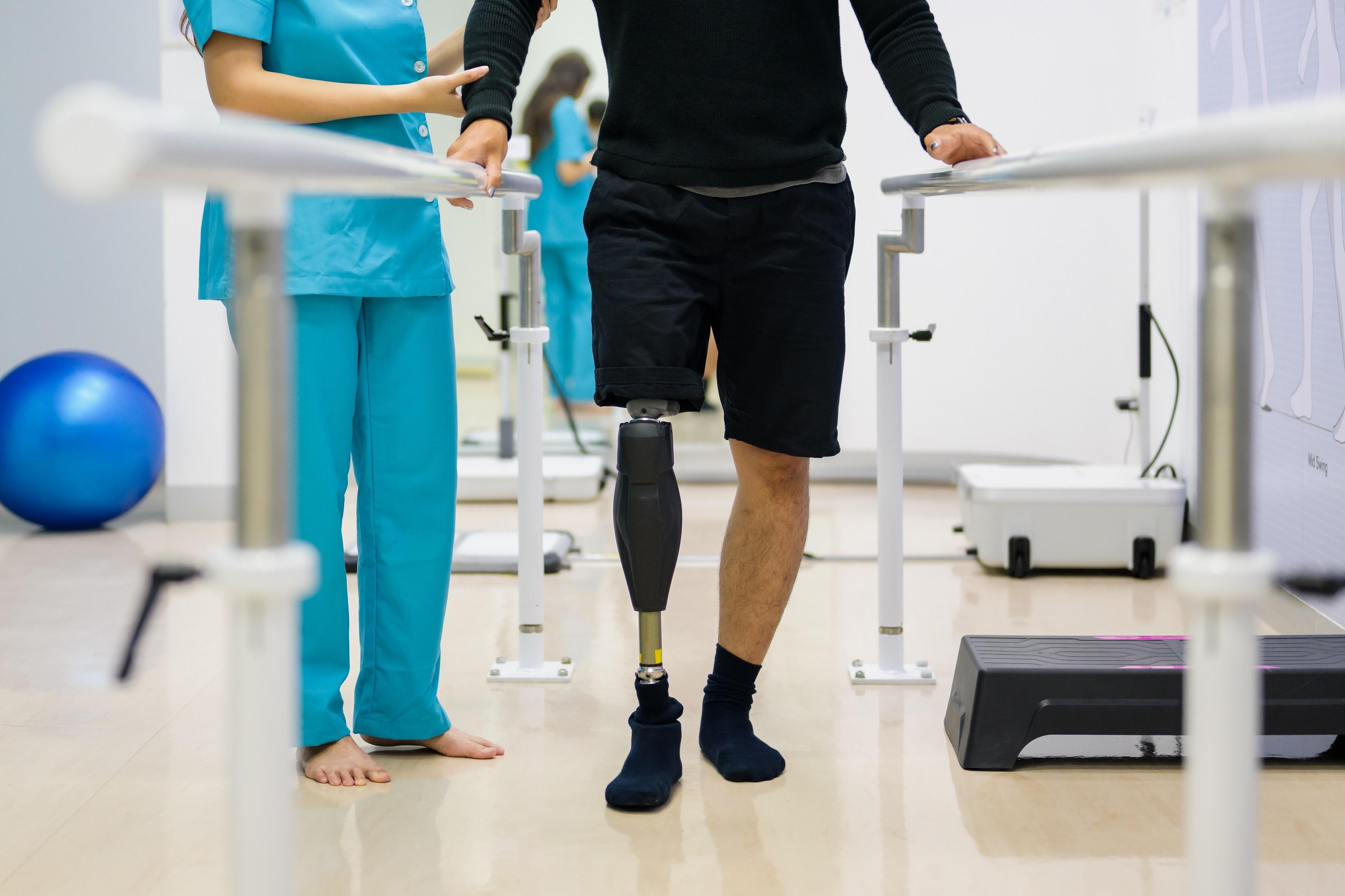 Amputation | Limb Loss | MedlinePlus