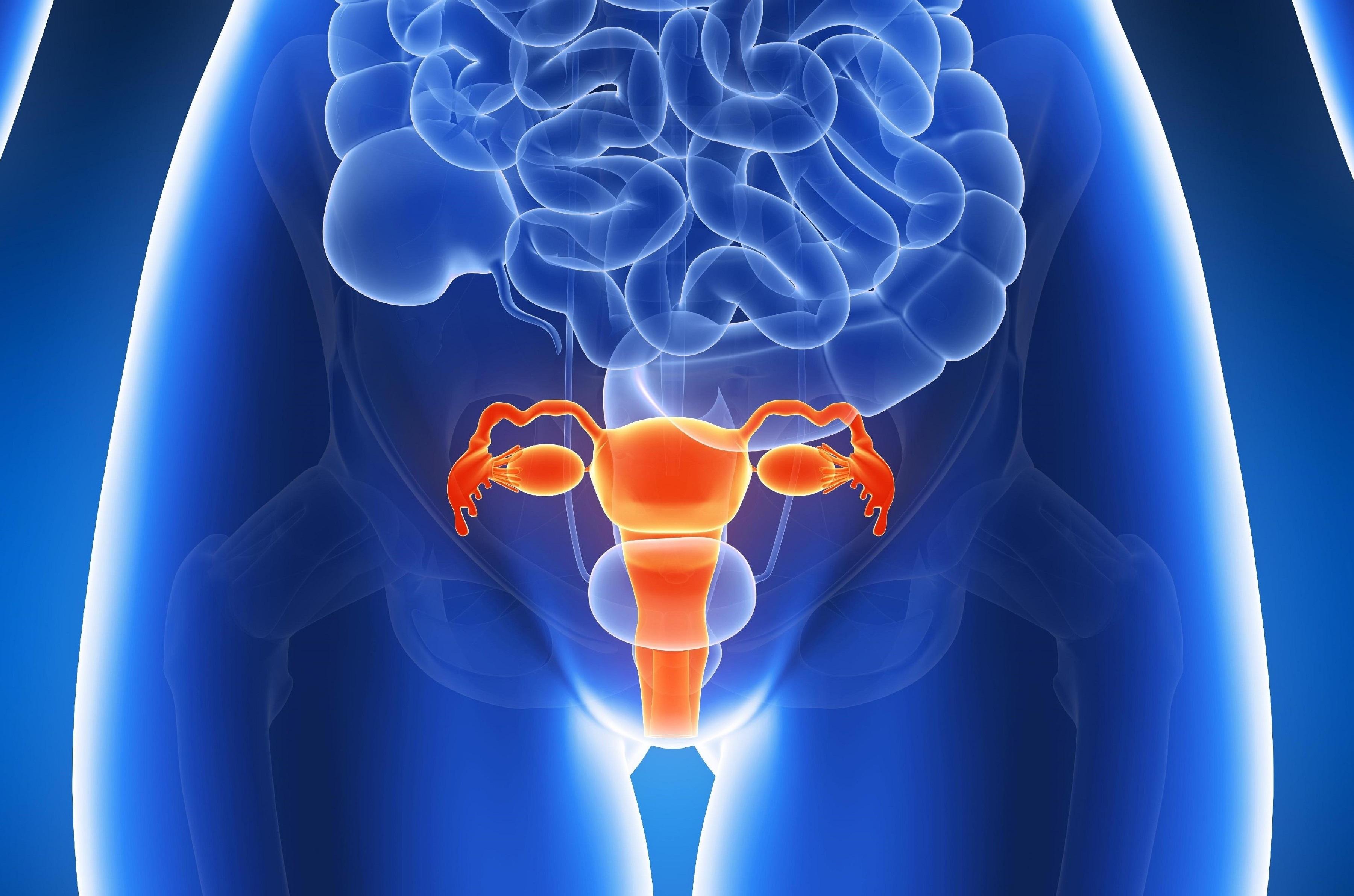 Uterine Cancer | Endometrial Cancer | Hysterectomy | MedlinePlus